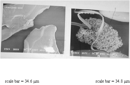 Effects of Radiation on the Physical Properties of SuperLig 44 Resin